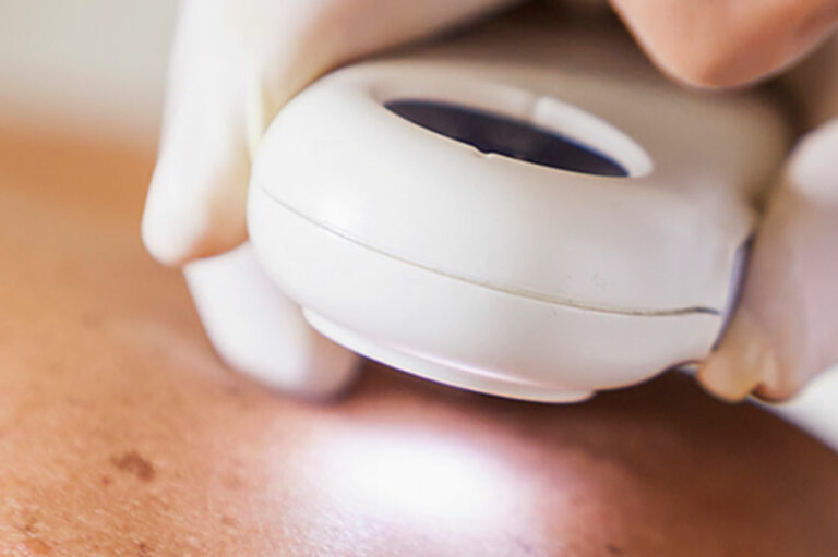Skin Cancer Doctors in North Texas | Skin Cancer Specialists