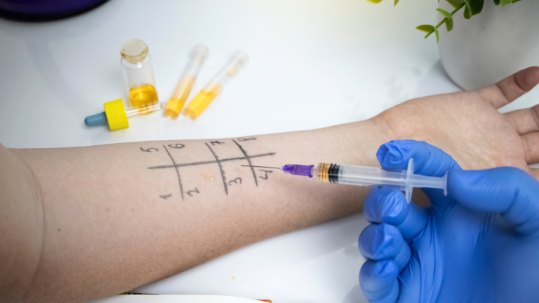 What is an Allergist? When to See One & What to Expect?